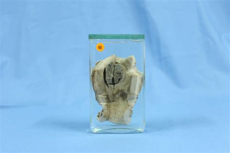 生殖系统疾病