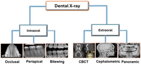 Multi Label Dental Disorder Diagnosis Based On Mobilenetv2 And Swin Transformer Using Bagging