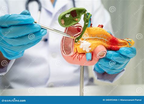 Pancreatitis Pancreatic Cancer Asian Doctor With Pancreas Gallbladder And Bile Duct Human