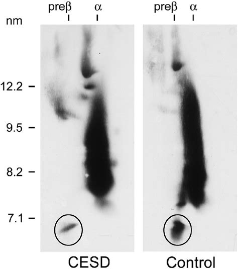 2d electrophoretic analysis of hdl preb and a migrating hdl subclasses