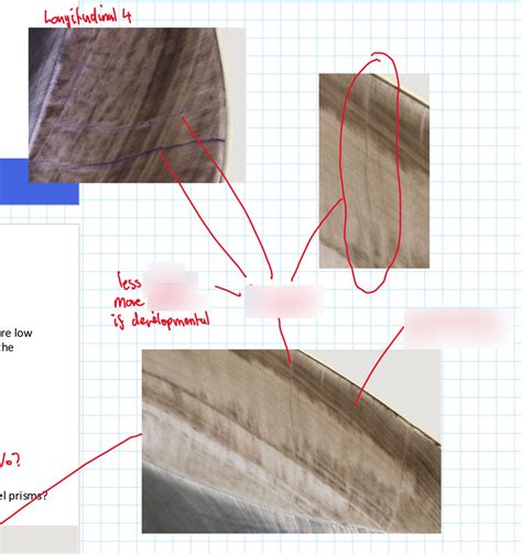 Diagram Of Enamel 1 Quizlet
