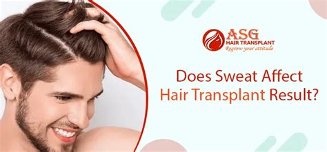 Top Effects Of Hair Transplant Surgery Polarrunningexpeditions