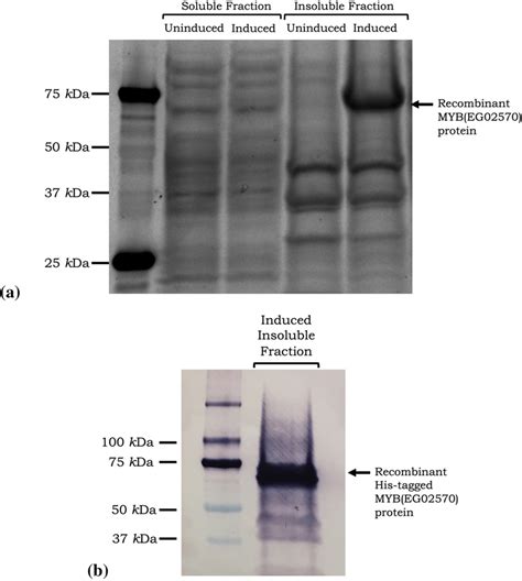 A Sds Page Gel Of Soluble And Insoluble Fractions Of Uninduced