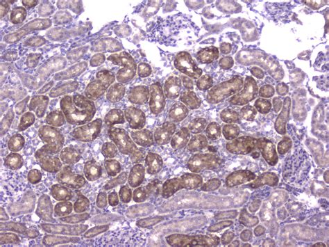 Mcp 2 Antibody Pa5 95539