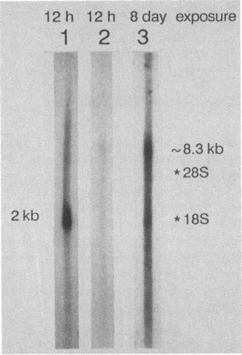 Northern Blot Hybridization Of Rna From Ganglia Of Latently Infected