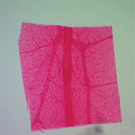 Mammal Lymphatic Vessel W M Microscope Slide Carolina Biological Supply