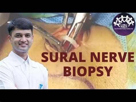 Sural Nerve Biopsy