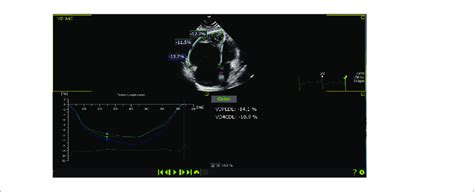 Autostrain Rv Tomtec Primary Pulmonary Hypertension Obtained Value