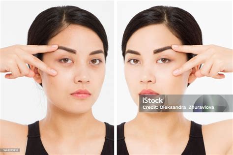 아시아 는 화장품 절차 후 전에 여자 행복 얼굴을 닫습니다 피부 관리 주름 얼굴 눈 아래 다크 서클 노화 방지 페이스 리프트 트리트먼트 전 페이셜 스킨케어 뷰티 컨투어링