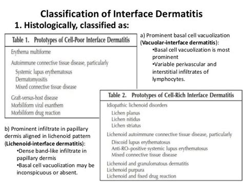 Interface Dermatitis Tutorial