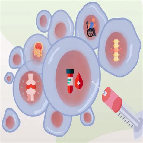 Stem Cell Treatment For Czech Republic In India Stem Cell Care India