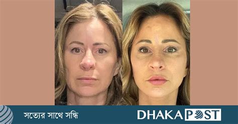 বাড়ি বেচে মুখে প্লাস্টিক সার্জারি করে নিঃস্ব এখন থাকেন ভ্যানে