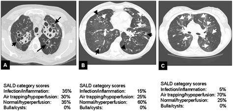 The Spectrum Of Structural Abnormalities On Ct Scans From Patients With