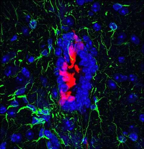 Untapped Potential Of Stem Cells Could Aid Repair Of Spinal Cord Damage