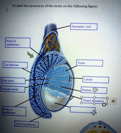 Label The Structures Of The Testis On The Following Figure 1 Spermatic Cord 2 Head Of