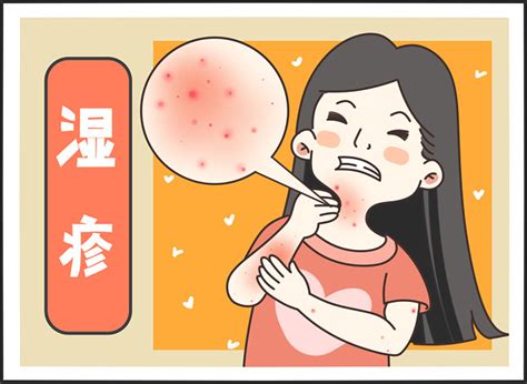 出血点 荨麻疹 湿疹 皮炎 过敏性皮炎 蜘蛛痣 血管瘤图片 出血点图片素材 花瓣网