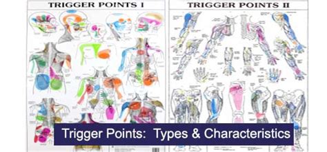 4 Types And 8 Characteristics Of Trigger Points