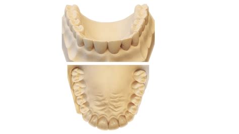 Dental Othodontic Model Resin Dental Resin 3d Printer Purple Dance