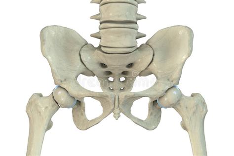 Subcapital Femur Fracture 3d Illustration Stock Illustration