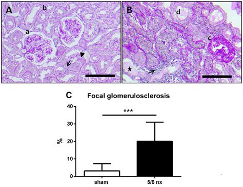 Representative Pictures Of Renal Histology In A Sham Operated A And