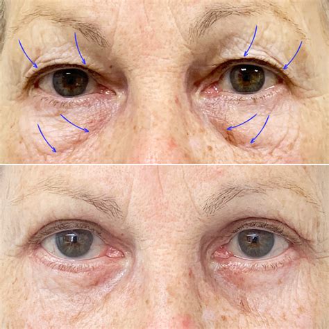 Пластична хірургія Офтальміка Естетікс