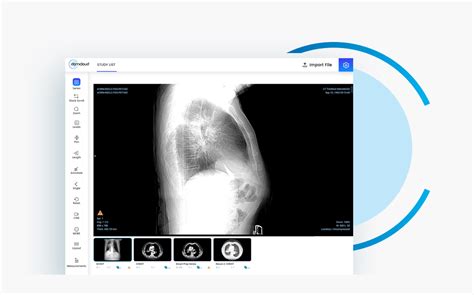 Web Based Dicom Viewer Without The Pacs Dcmcloud Dcmcloud