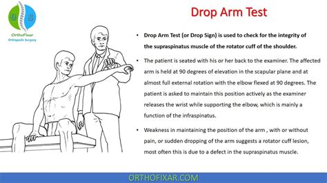 Drop Arm Test For Supraspinatus Tear OrthoFixar 2025