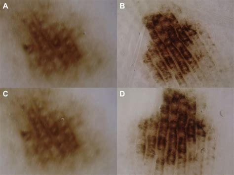 Lattice Like Pattern Observed Using A Ultrasound Jelly With Download Scientific Diagram Lattice Like Pattern Observed Using A Ultrasound Jelly With Download Scientific Diagram