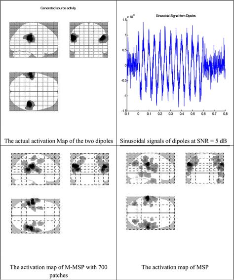 Activation Maps For Msp And M‐msp With 700 Patches Color Figure Can Be