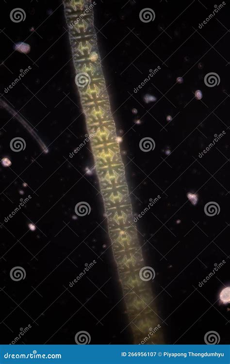 Protozoa And Plant Cells Under The Microscope For Education Stock Image Image Of Cilia