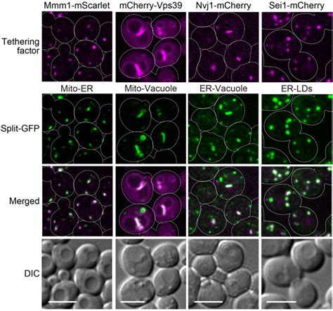 Improved Split Gfp Systems For Visualizing Organelle Contact Sites In