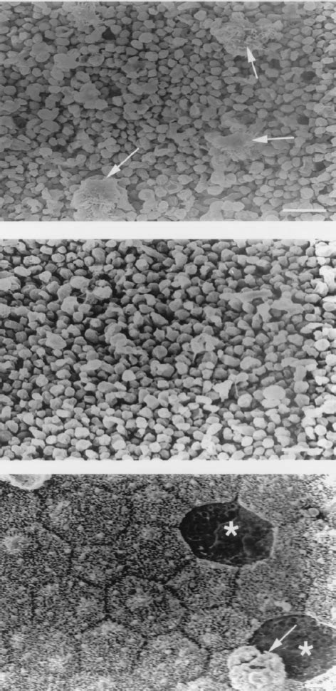 Scanning Electron Microscope Photographs Of Photoreceptor Outer Segment Download Scientific