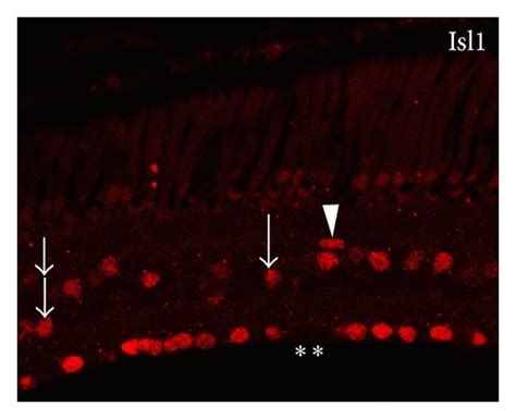 Morphological Features And Expression Patterns Of Isl1 And Other Cell