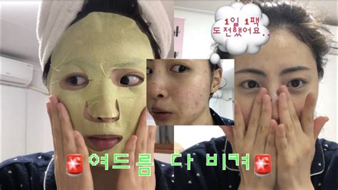 🚨여드름 다 비켜🚨여드름성 피부의 1일1팩 10일 도전기 듀이트리 Ac 컨트롤 Ex 딥마스크 Youtube