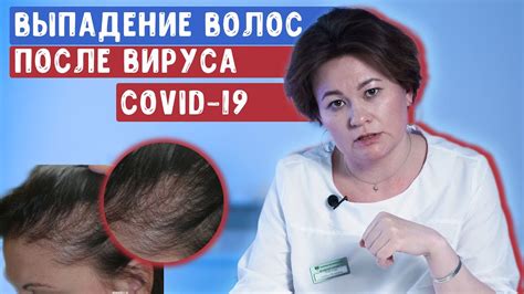 Выпадение волос после ковида - как остановить выпадение волос - YouTube