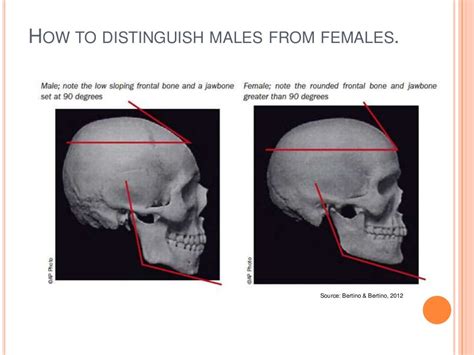 Forensic Science 06 Skeletons And Bones