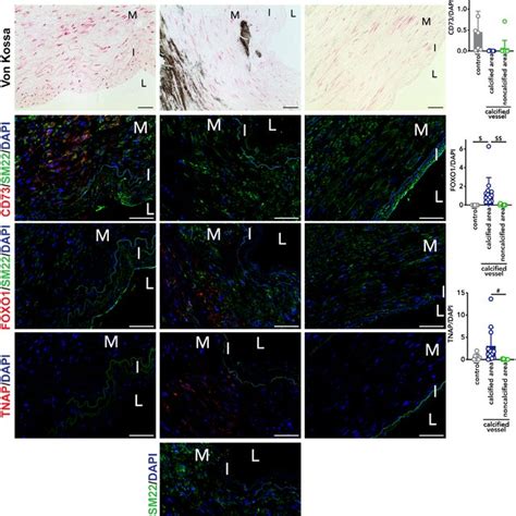 Cd73 Levels Reduced In Nonarterial Calcification Due To Deficiency Of