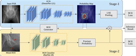 The Proposed Two Stage Fracture Detection System The First Stage Uses Download Scientific