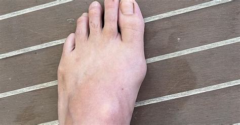 Foot Album On Imgur