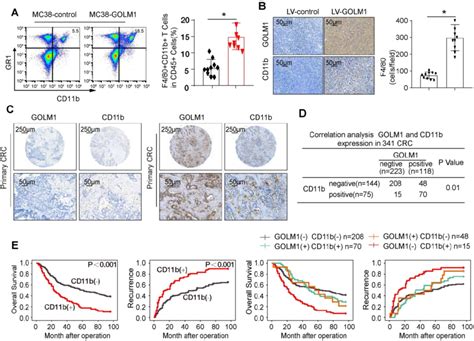 GOLM1 Promotes CRC Progression In Immunocompetent Mice By Recruitment