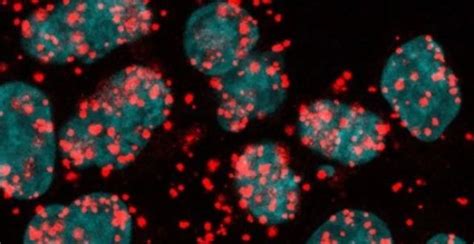 Science Advances：黏连蛋白新功能发现，影响基因的选择性剪接，突变则将导致癌症！腾讯新闻