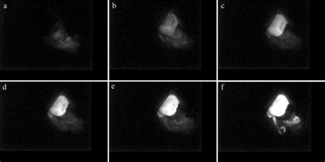 Icg Fluorescence Imaging Process A 5 S After Icg Injection B 15 S