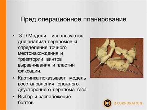 Презентация Использование 3d технологии в медицине скачать проект