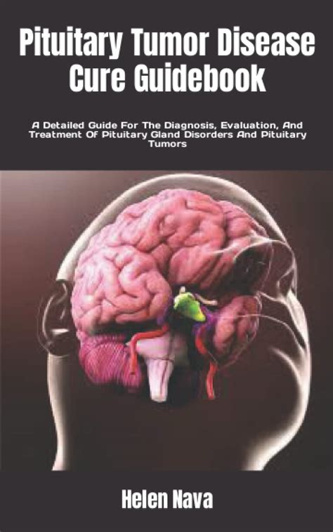 Buy Pituitary Tumor Disease Cure Guidebook A Detailed Guide For The
