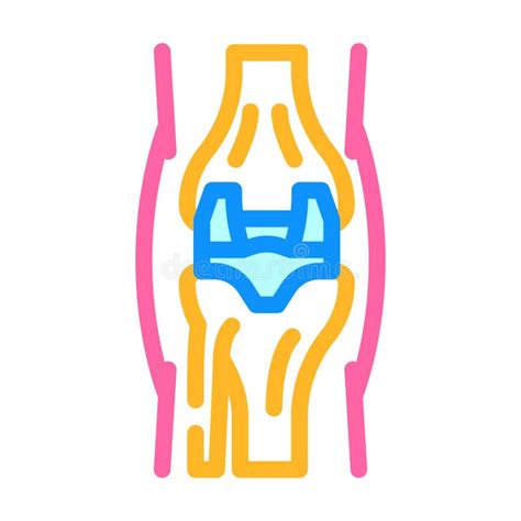 Joint Replacement Surgery Color Icon Vector Illustration Stock