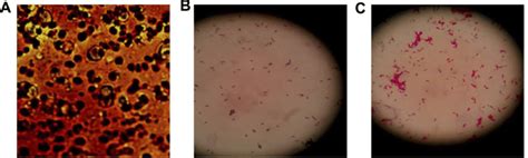 Mycobacterium Fortuitum