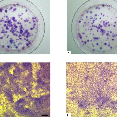 Nc Msc Clonogenicity And Self Renewal Capacity A Cfu F Assay B A