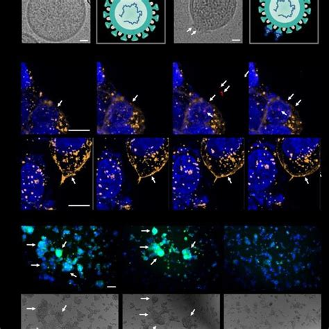 A Cryo Em Imaging Of Macth 4 Binding With Pseudovirus Scale Bar 20
