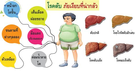 โรคตับ เลซิตินกิฟฟารีนเพื่อคุณ