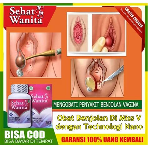 Jual Obat Benjolan Di Miss V Dengan Technologi Nano Herbal Penghilang